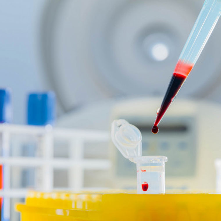 Best Pathology Laboratory in Gandhinagar | Nidan Path Lab