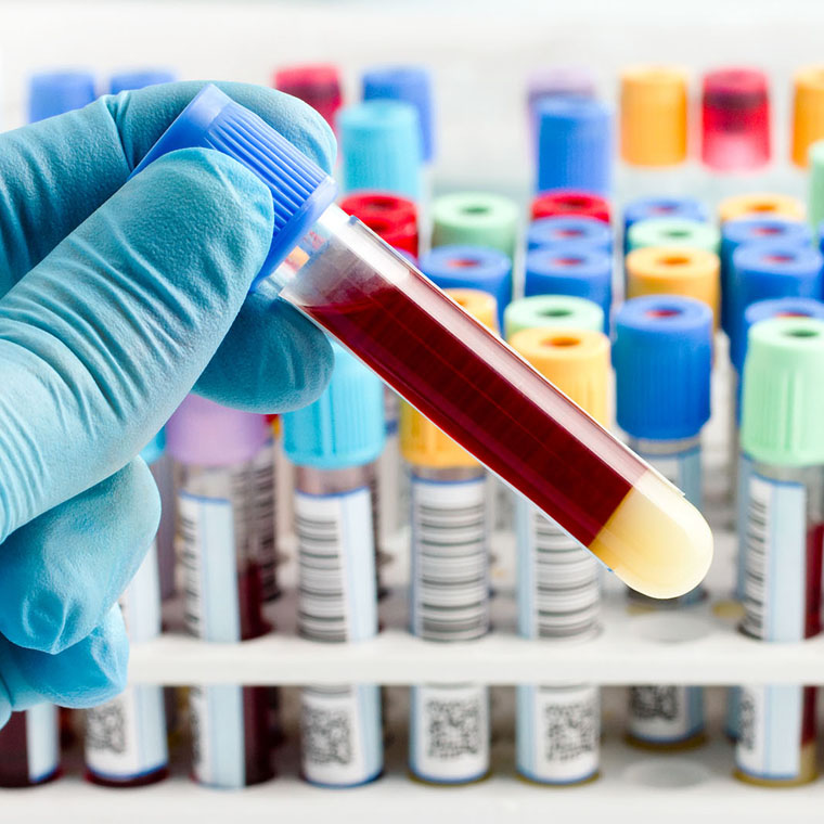 Best Pathology Laboratory in Gandhinagar | Nidan Path Lab